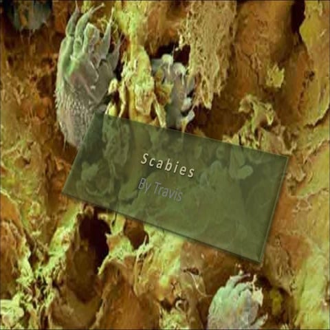 5(b)..new scabies | PPT