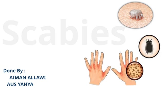 Scabies | PPTX