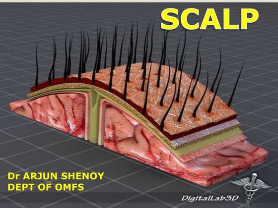 Scalp | PPT
