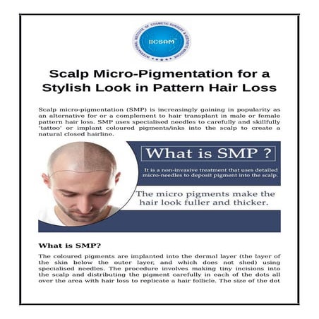 Scalp Micro-Pigmentation for a Stylish Look in Pattern Hair Loss | PDF