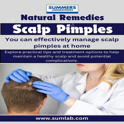 How can I effectively treat scalp pimples at home? | PDF