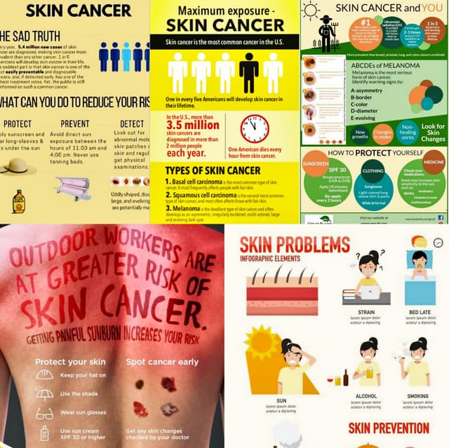 Skin Cancer | PPTX