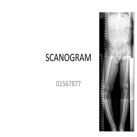 SCANOGRAM.pptx