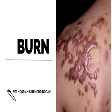 Burn and Scar management in occupational therapy | PDF