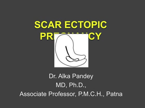 Caesarean scar pregnancy.ppt