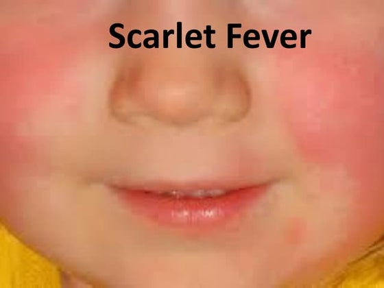 طلاب كروب D Osce slides in gynaecology-1 (Muhadharaty).pptx