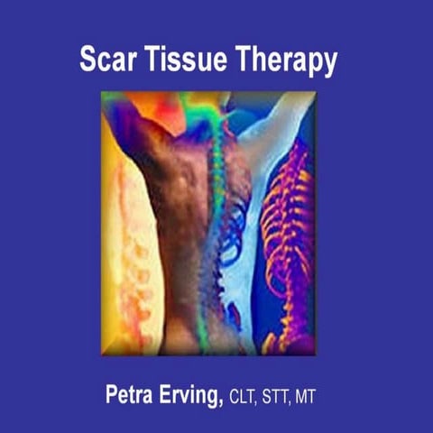 Scar Tissue Therapy Presentation Plastics | PPTX