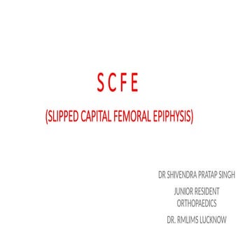 SCFE.pptx /slipped capital femoral epiphysis | PPTX