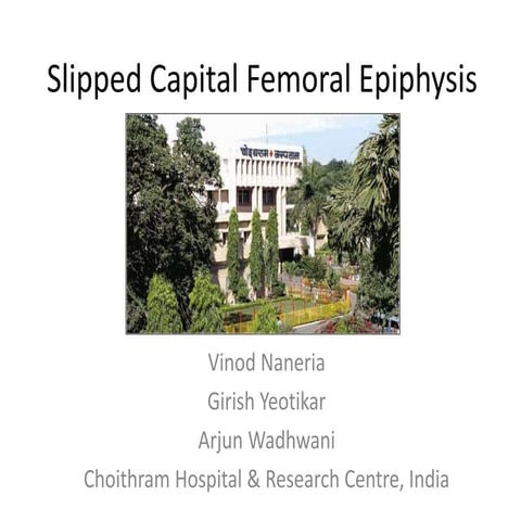 Slipped Capital Femoral Epiphysis | PPT
