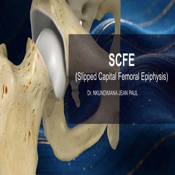 Slipped Capital Femoral Epiphysis (SCFE) DR NKUNDIMANA JEAN PAUL.pptx