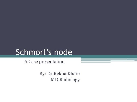 Imaging of lumbar spondylosis | PPTX