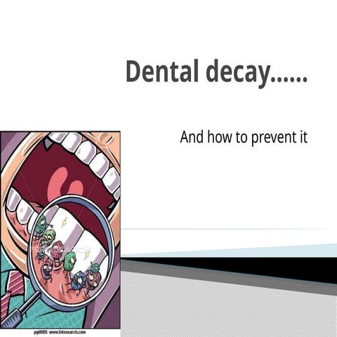 Tooth decay in children | PPTX