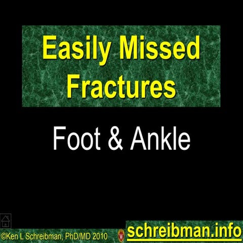 Easily Missed Fracture Foot & Ankle Radiology Lecture | PPT