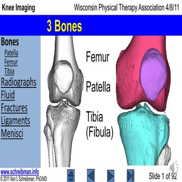 Knee Imaging narrated MSK Radiology Lecture | PPSX