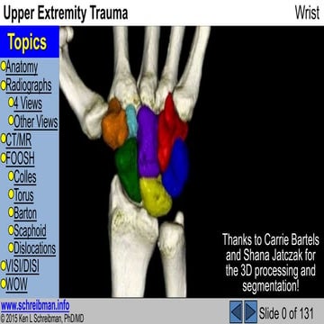 Upper Extremity Trauma Wrist complete MSK Radiology Lecture | PPSX