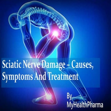 Sciatic Nerve Damage – Causes And Treatment | PPTX