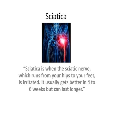 Sciatica | PPT