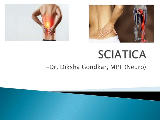 Rehabilitation of sciatica | PDF