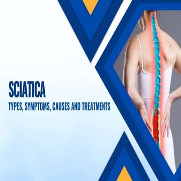 Sciatica- Types, symptoms, causes and Treatments | PPTX