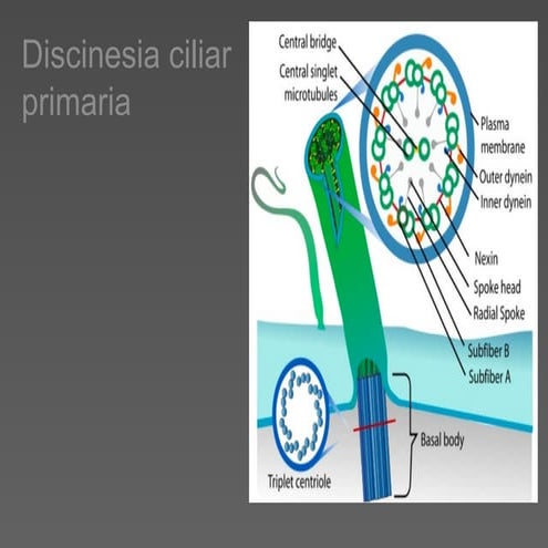 DISCINCECIA CILIAR PRIMARIA YASMIN ).pptx