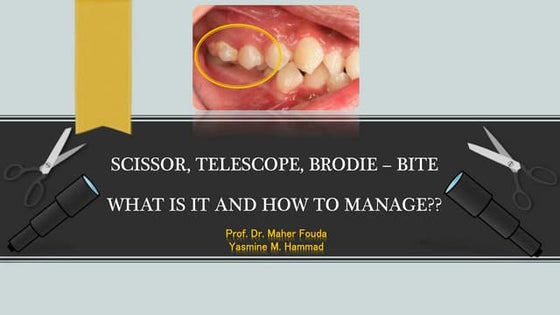 Scissor bite | PPT