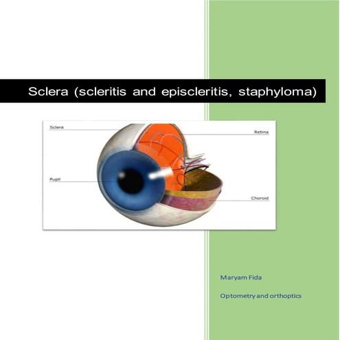 Management of trauma Ropper Hall classification system (Preventive op…