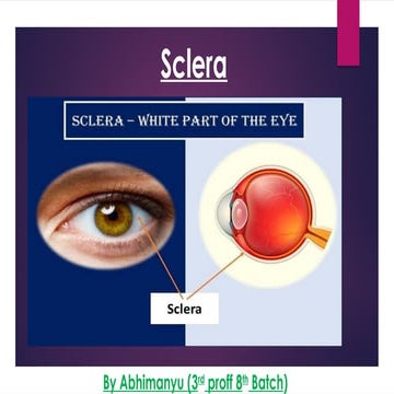 Sclera | PPTX