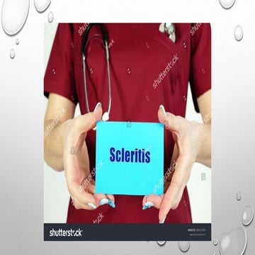SCLERITIS.pptx