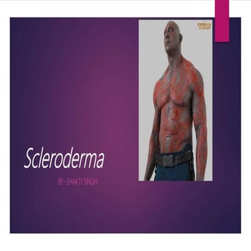 Scleroderma dermatology | PPTX