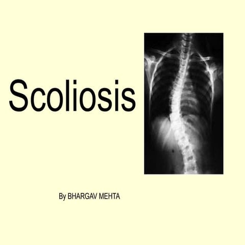 Scoliosis | PPTX