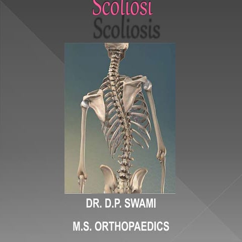 Lenke Classification for Adolescent Idiopathic Scoliosis (AIS) | PPTX
