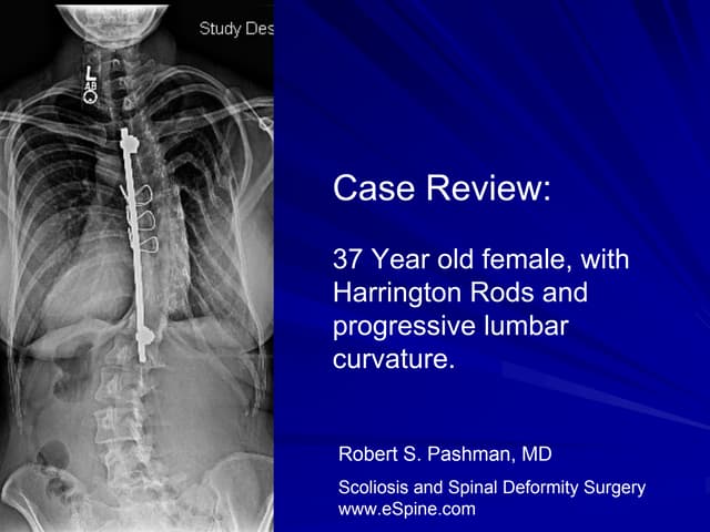 Case Review 28 Patient With Lumbar Scoliosis Status Post Surgery With