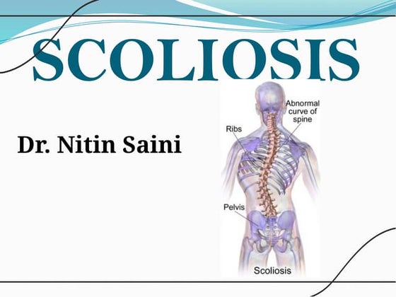 SCOLIOSIS assessment, types and management | PPT