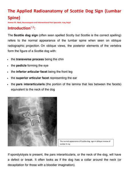 Babinski REFLEX AND PATHOPHYSIOLOGY.pptx | Death, Injury, or Military ...