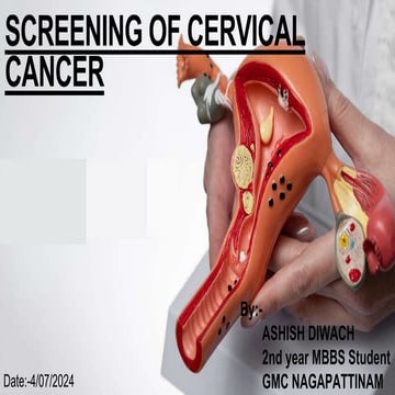 Screening Of Cervical Cancer Ppt For Mbbs Pptx 6016