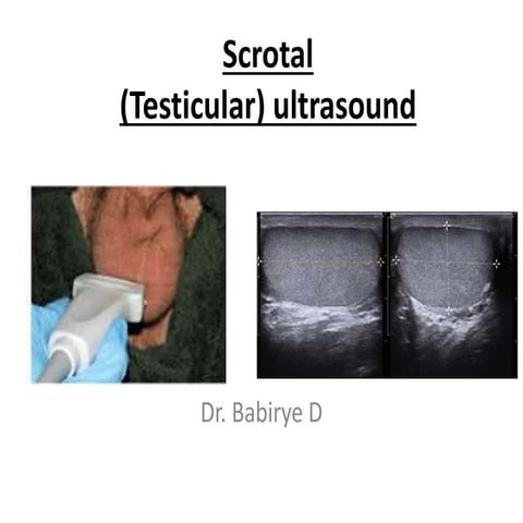 scrotal doppler | PPTX