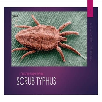 Scrub typhus | PPTX