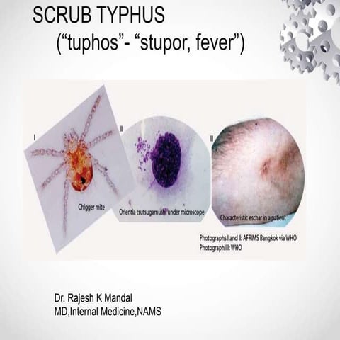 Scrub typhus | PPTX | Infectious Diseases | Diseases and Conditions