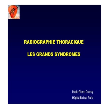 Syndrome bronchique | PDF