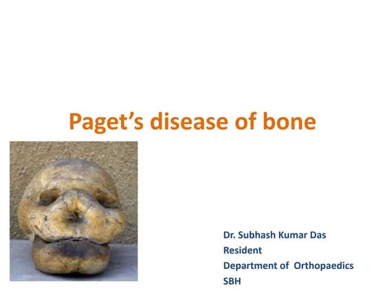 OSTEOPOROSIS.pptx