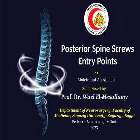 Posterior pedicular spine screws entry points | PPSX