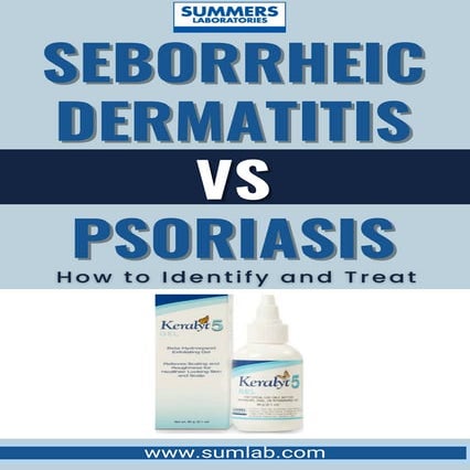 How Can You Tell The Difference Between Seborrheic Dermatitis And 9638