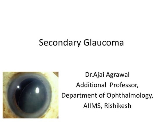 Neovascular Glaucoma presentation made easy | PPTX | Eye and Vision ...