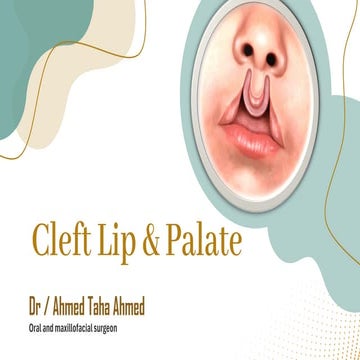Cleft lip and palate and prosthesis neonates | PDF