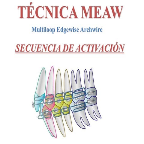 Secuencia de los arcos Meaw Sadao Sato.pptx