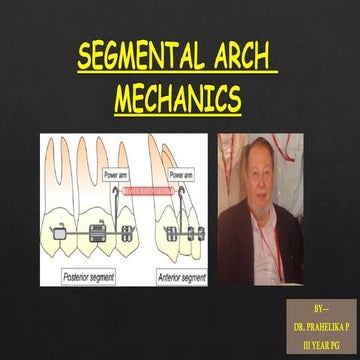 SEGMENTAL ARCH..... ..........pptx