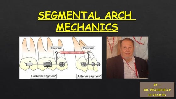 TORQUE AND ITS APPLICATION TO ORTHODONTICS.pptx