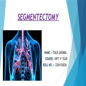 Surgical technique for gama nail | PPTX
