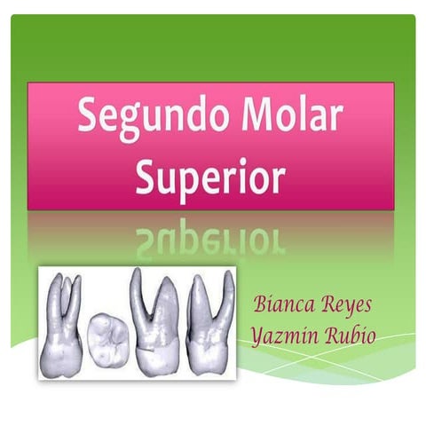 Anatomía dental de los molares superiores | PPTX