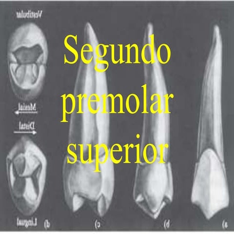 Segundo premolar superior y inferior | PPT